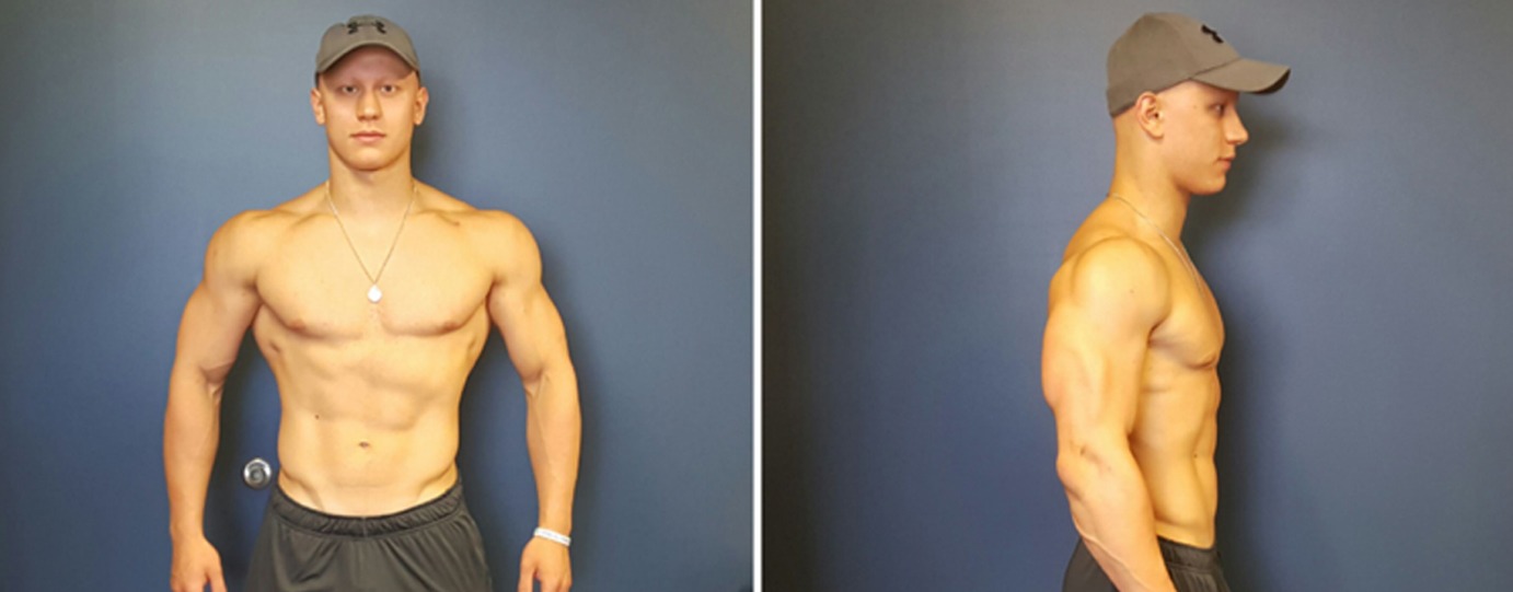 How Much Protein Should I Eat? An Athlete’s Guide to Calculating ...